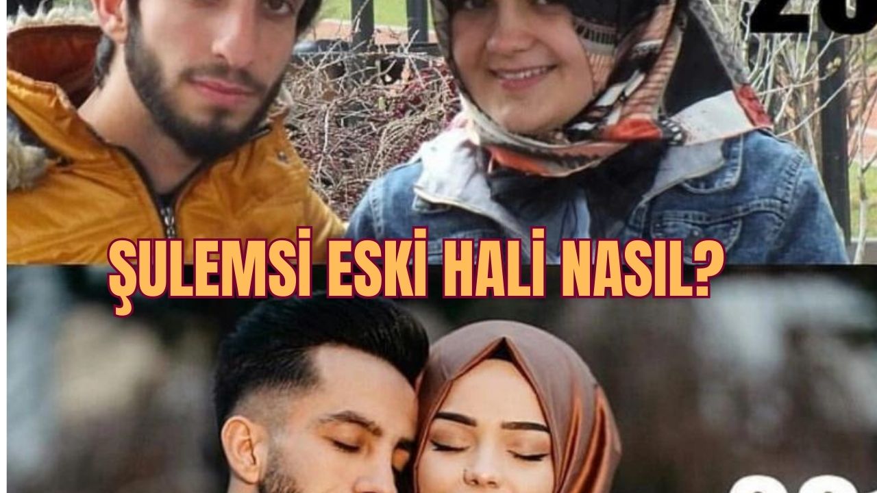 Şulemsi Eski Hali Nasıl? Şule Karatürk Estetiksiz Hali Şaşırttı ...